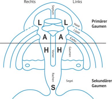 Was ist Cleft? – Deutsche Cleft Kinderhilfe e.V.